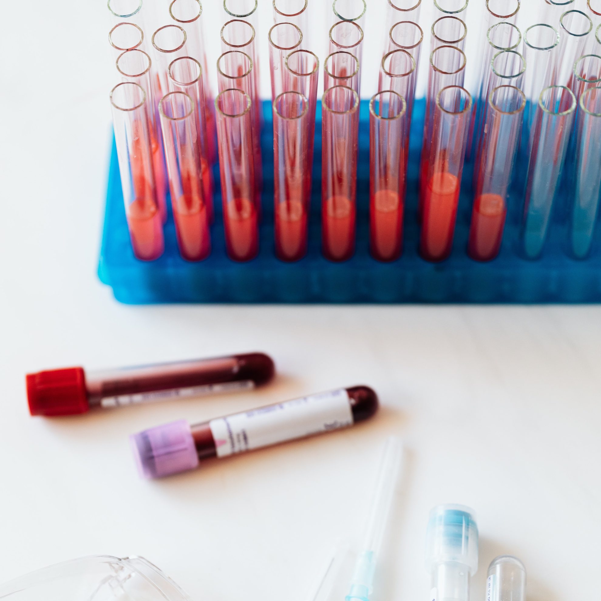 Polycythemia Vera Skin Conditions: Causes and Treatments