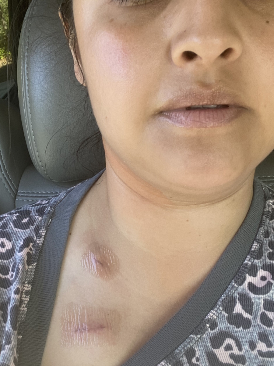 Stage 4 Colon Cancer Spreads to Liver - Dania's Story of Hope