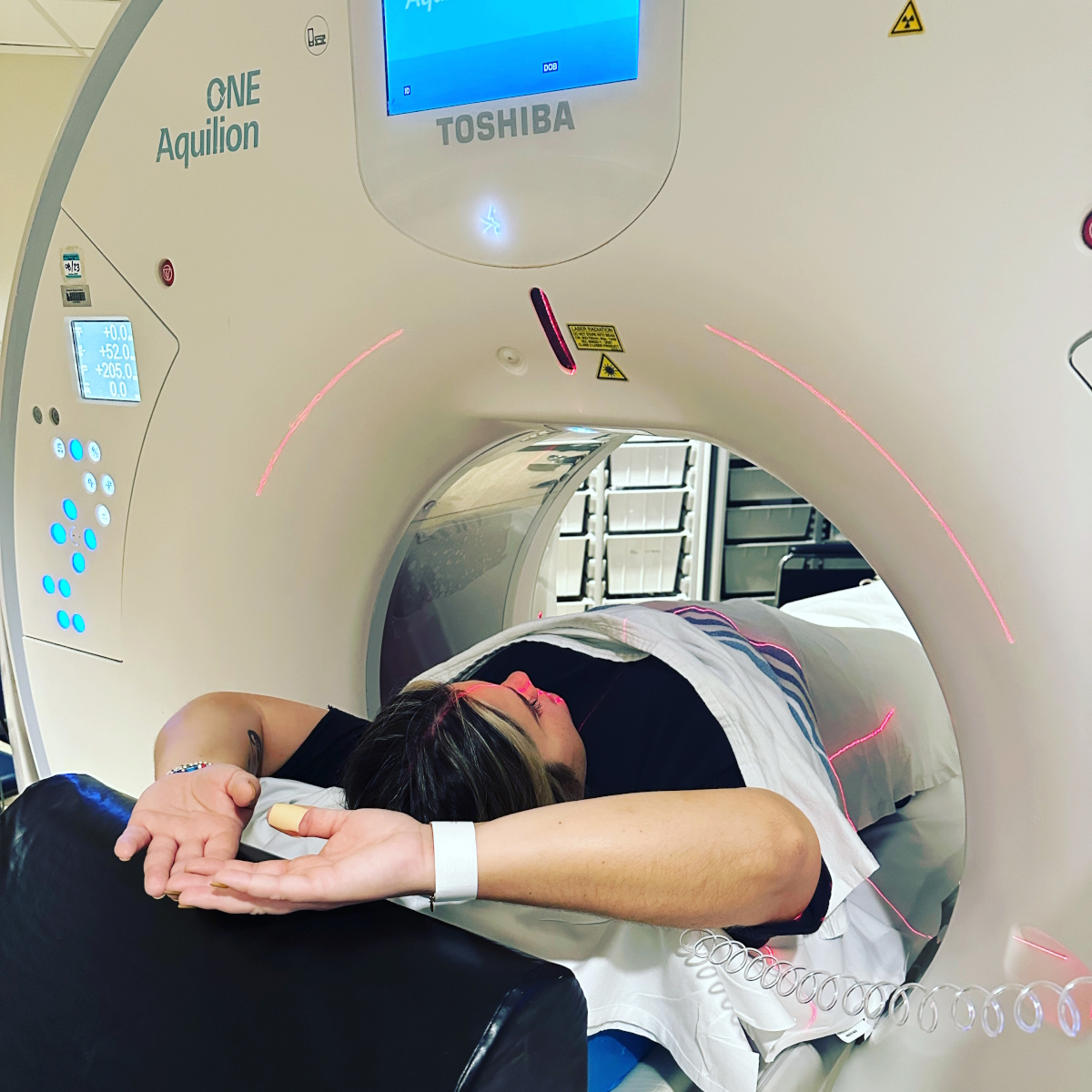 Stomach Aches, Bloating, and Fatigue: Stage 3 Colon Cancer Story