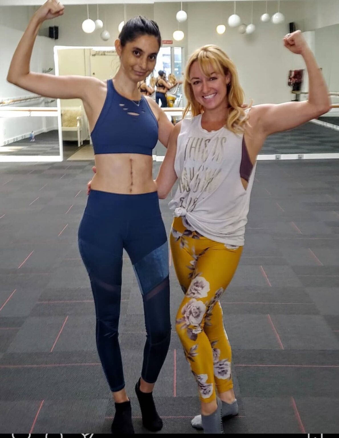 Elizabeth's Stage 4 Colon Cancer Story - The Patient Story