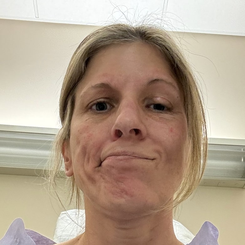 Melissa's Rare Brain Tumor Story - The Patient Story